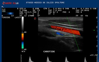 Eco Color Doppler - Poliambulatorio Medico De Iuliis